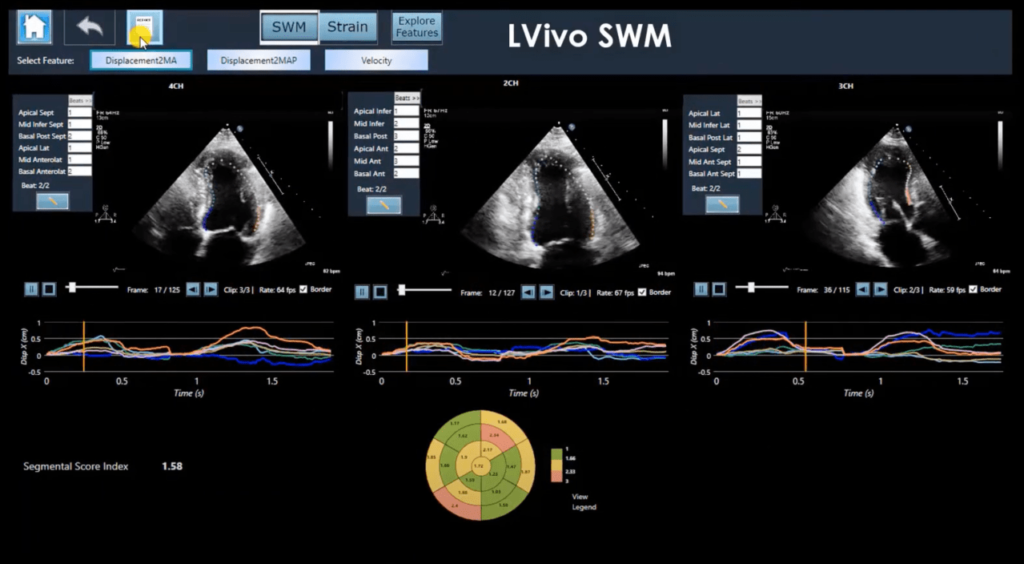 DiA Imaging Analysis: Pioneering the Future of AI-Driven Ultrasound ...